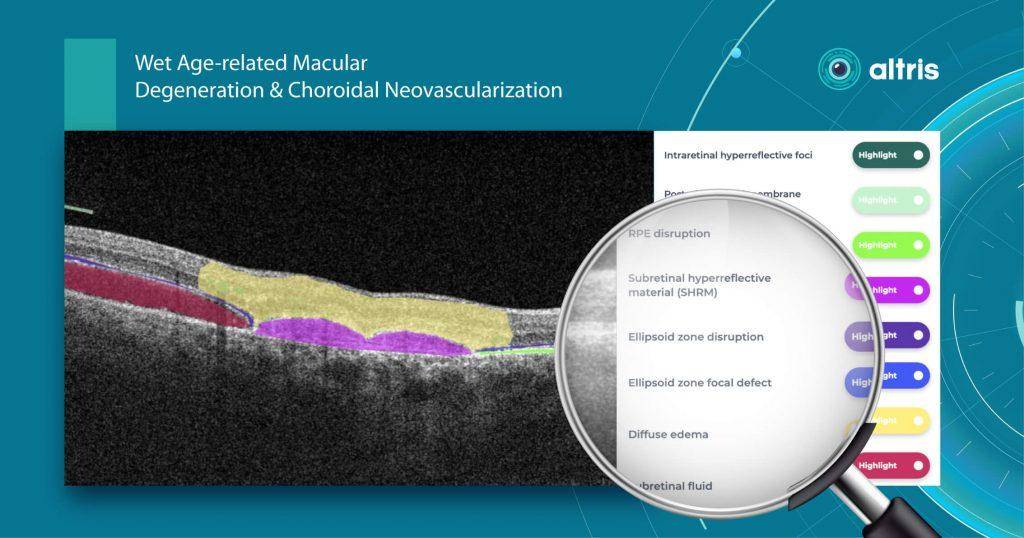 OCT Examination VS Fundus Photography: What to Choose