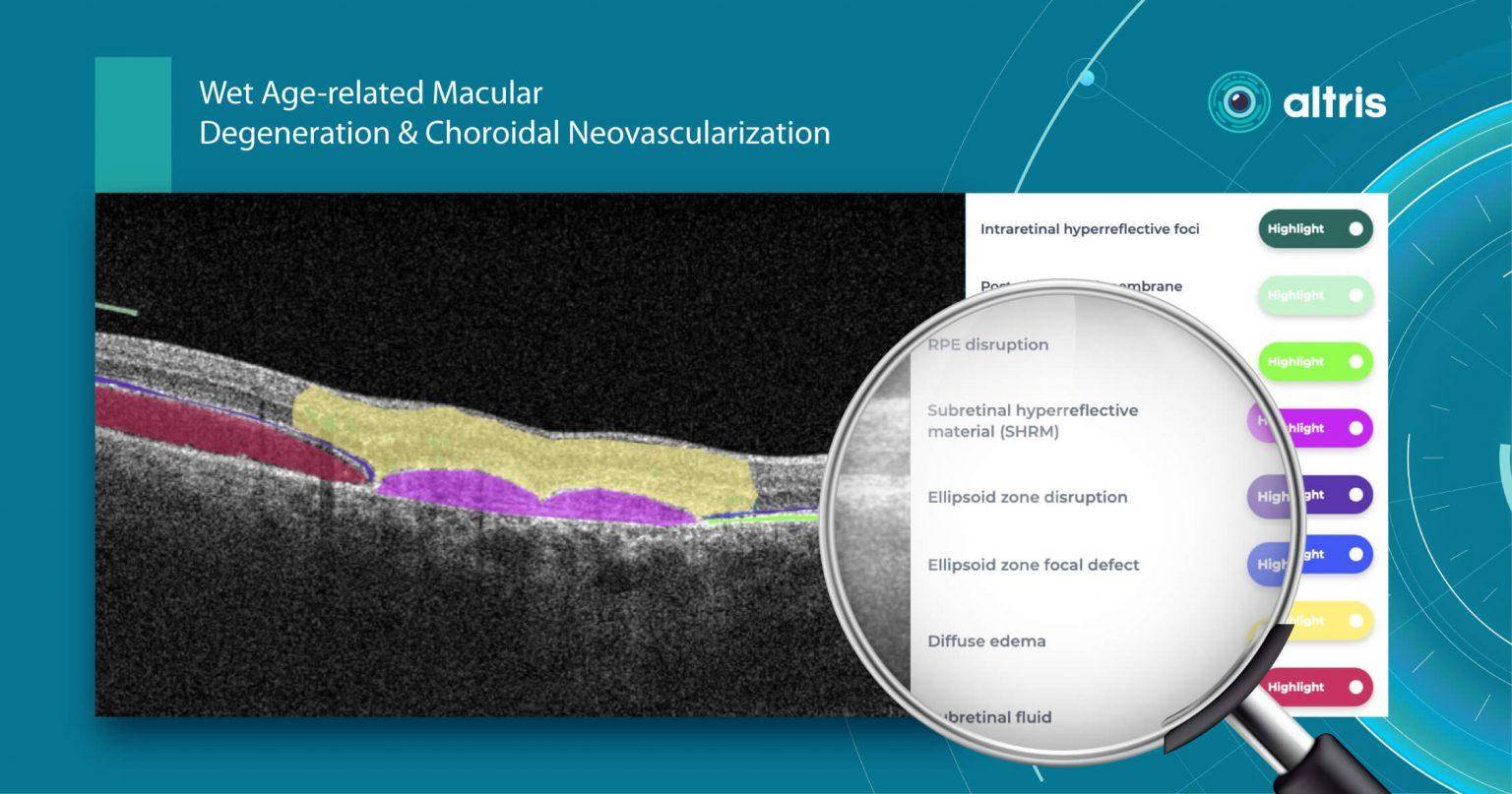 OCT Examination VS Fundus Photography: What to Choose