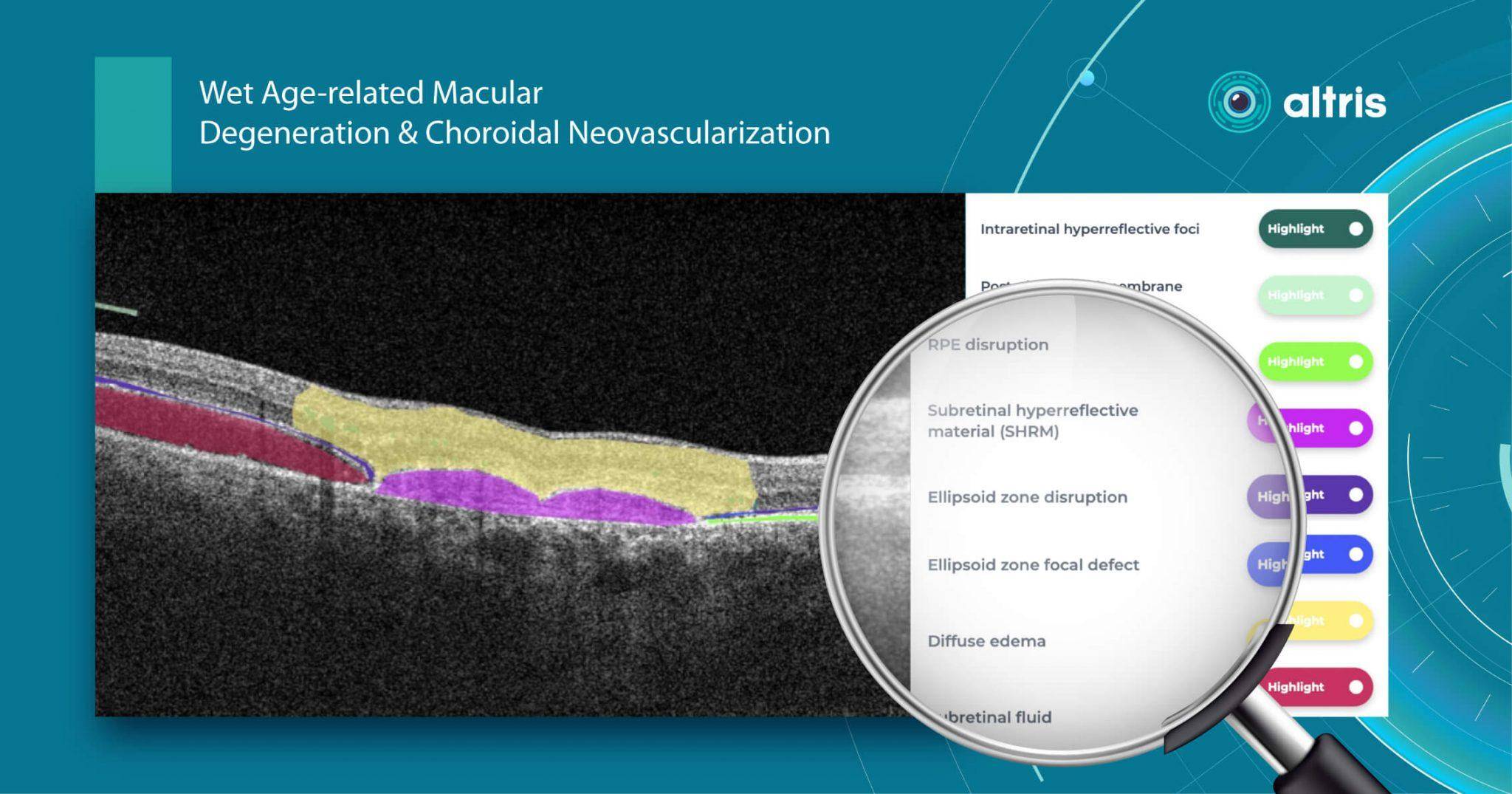 OCT Examination VS Fundus Photography: What to Choose