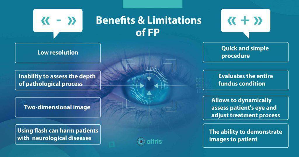 OCT Examination VS Fundus Photography: What to Choose