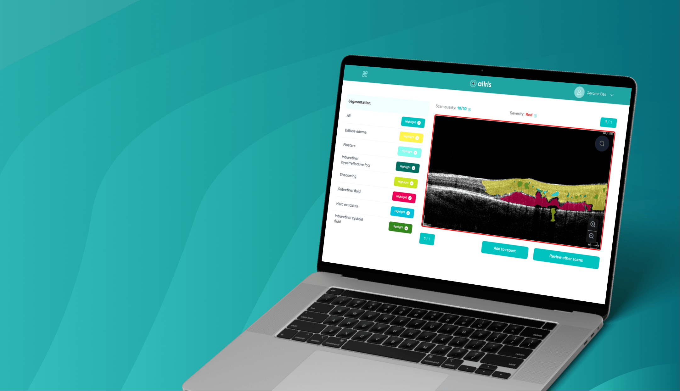 For Reading Center - altris