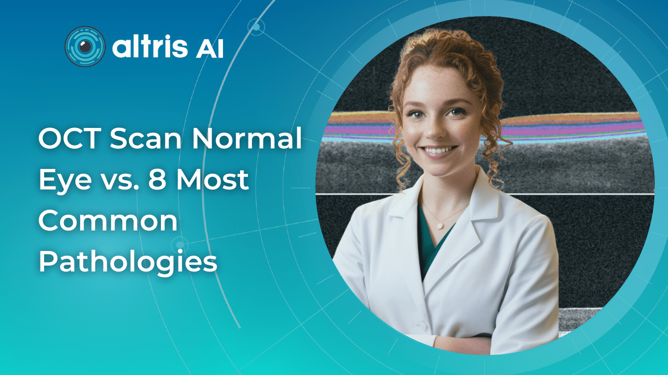 Our Blog – Artificial Intelligence for OCT Interpretation