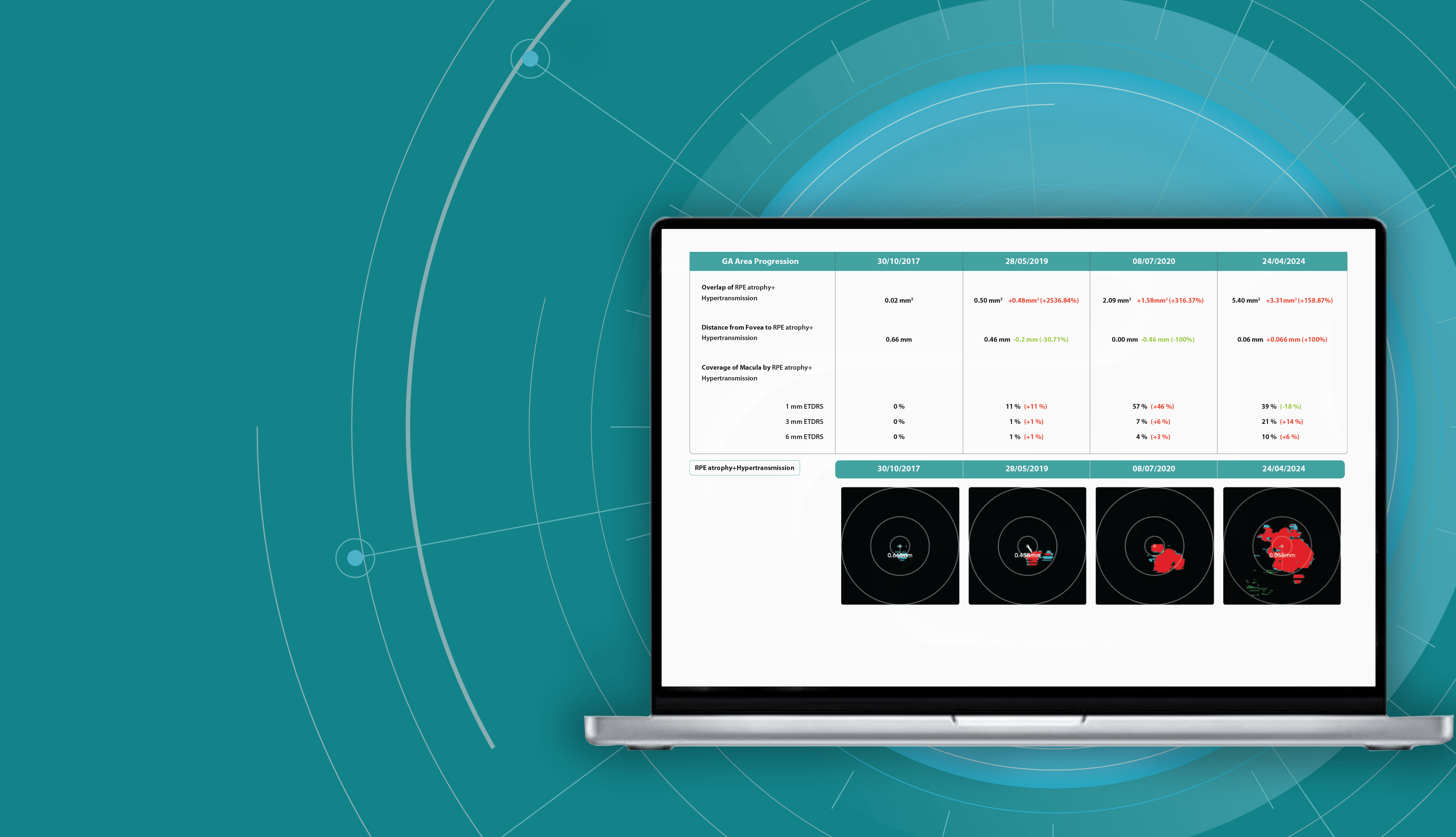 AI Ophthalmology and Optometry | Altris AI