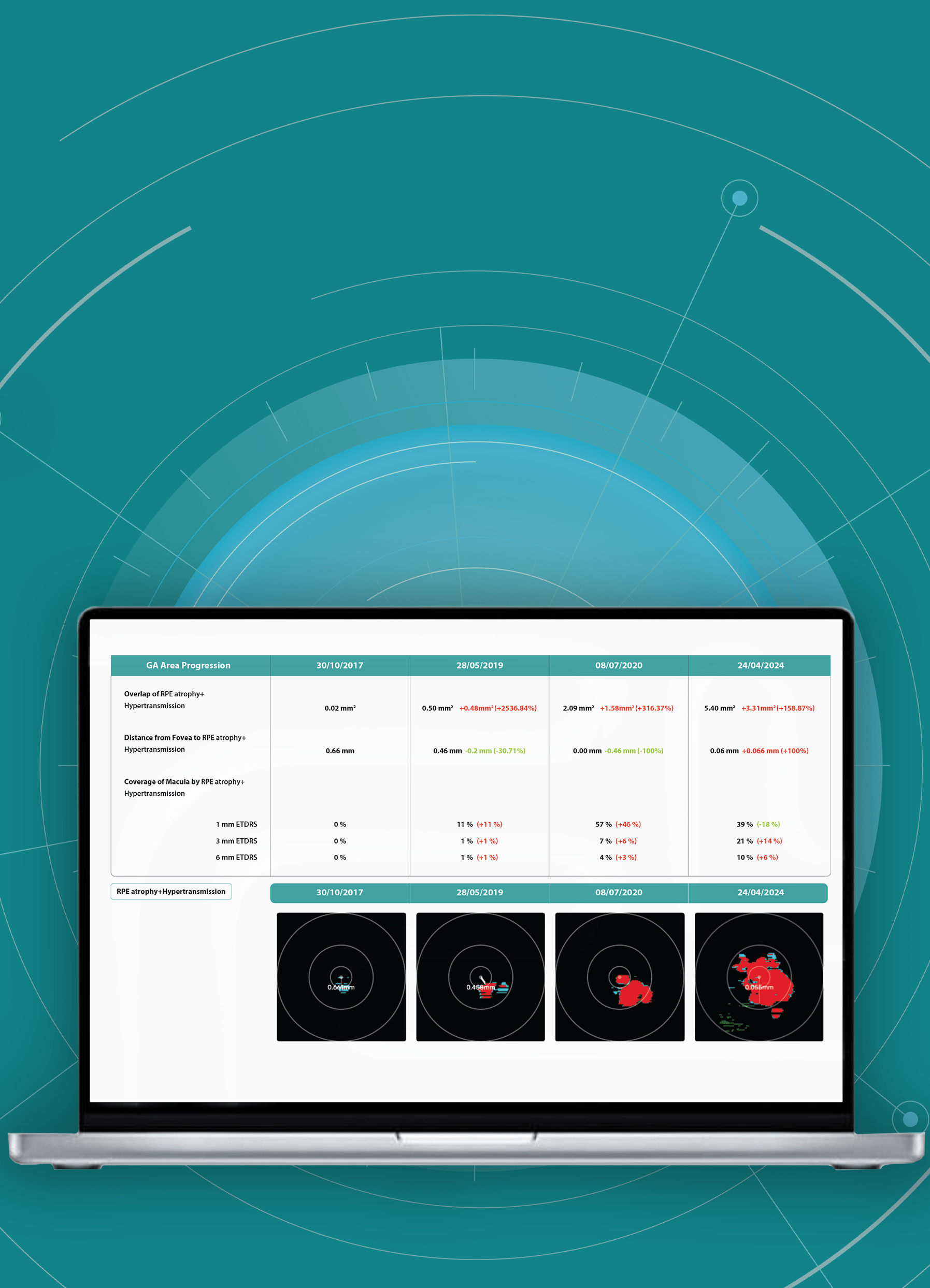 AI Ophthalmology and Optometry | Altris AI