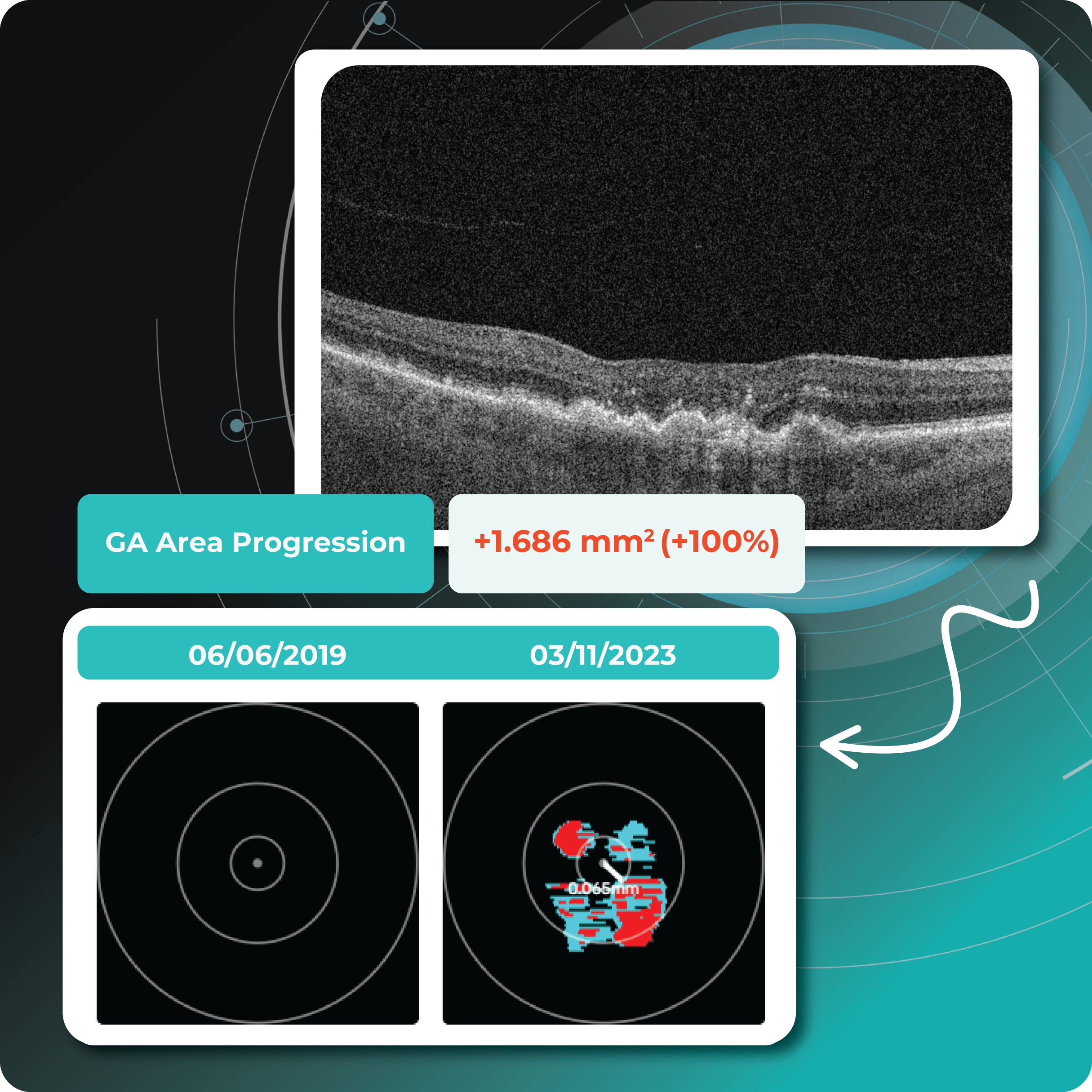 AI Ophthalmology and Optometry | Altris AI